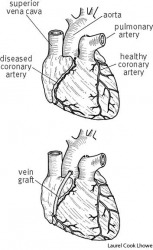 Bypass dictionary definition | bypass defined
